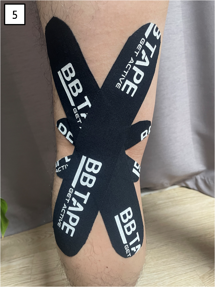 무릎 뒤쪽 오금 통증 완화해 주는 테이핑 방법 네이버 블로그