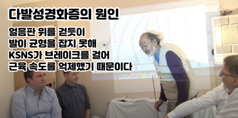 85. 다발성경화증 MS는 병, 척추 신경질환이 아니다. 3명 의학박사 입증과 설명 새로운 치료 발견, KSNS KSS 스본 스도 : 네이버 블로그