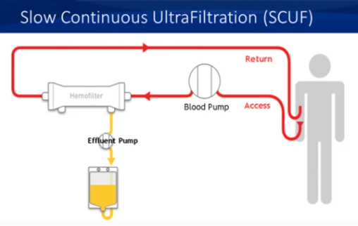 CRRT(Continuous renal replacement therapy) 원리와 Dose(처방), mode, UF, TMP ...