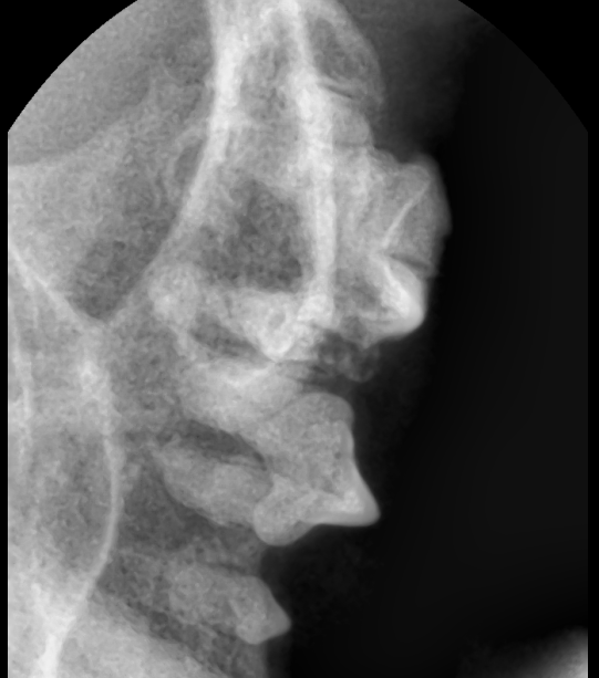 고양이 치아 흡수성 병변 (Feline Odontoclastic Resorption Lesion, FORL) : 네이버 블로그
