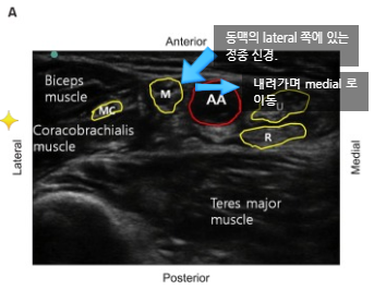 정중 신경 차단술 median nerve block, 정중신경의 주행에 대하여(초음파 유도하) : 네이버 블로그