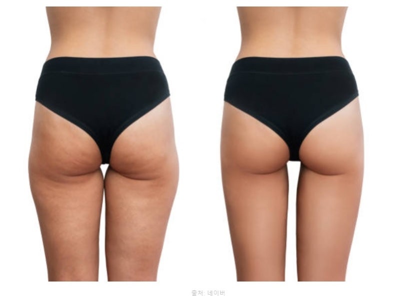 애플힙 힙업 효과 내는 맨몸 운동 자세 스쿼트 런지 힙브릿지 네이버 블로그