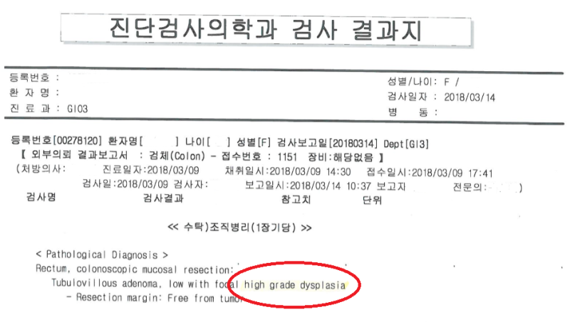 대장직장 및 결장 관상선종 D12 및 D01코드 고도이형성 보험금 챙기세요 Highgrade Dysplasia 네이버 블로그