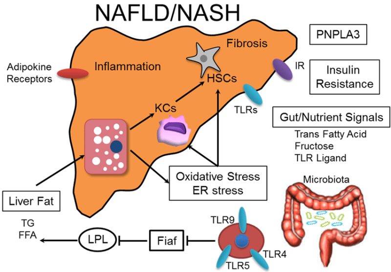 비알코올성 지방간염의 병태생리(Pathogenesis of nonalcoholic steatohepatitis) : 네이버 블로그