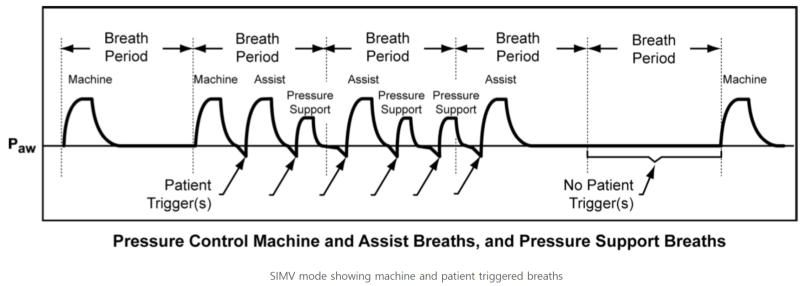 Ventilators, home vent mode : PCV, PSV, SIMV, CPAP : 네이버 블로그