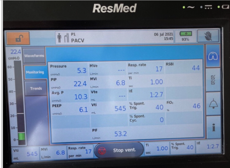 Ventilators, home vent mode : PCV, PSV, SIMV, CPAP : 네이버 블로그