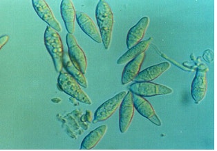 수도작 벼 병해충 정리 및 적용약제 설명 - 벼 도열병(잎도열병, 목도열병, 이삭도열병) : 네이버 블로그