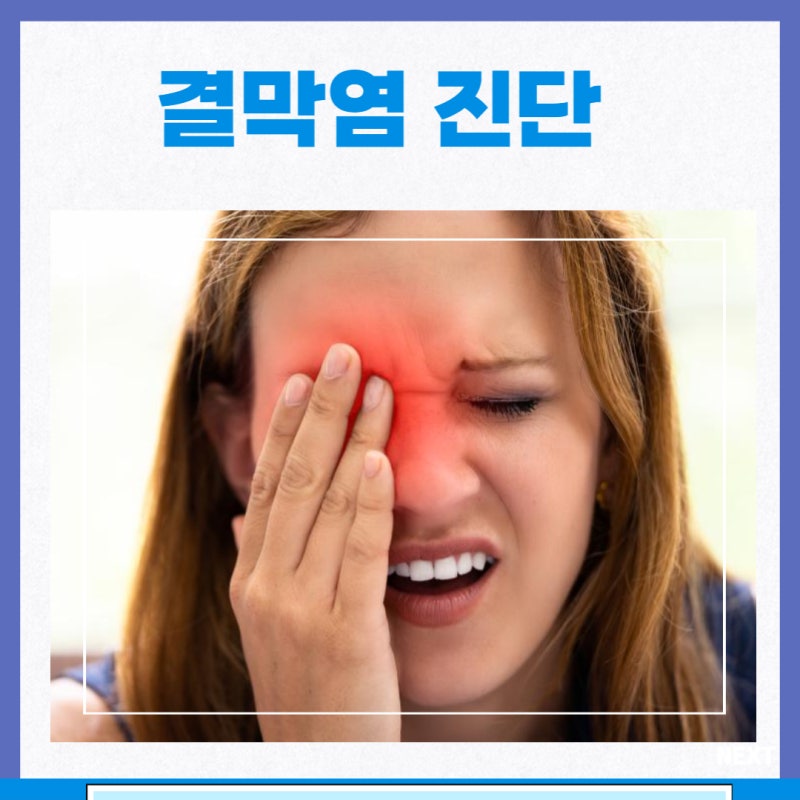 유행성 결막염 증상 전염 치료 알레르기 결막염 눈병 증상 네이버 블로그