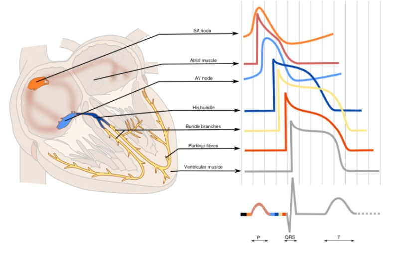 EKG, ECG, 심전도 기본개념(P, QRS, T, 심장 탈분극, SA node, NSR, Lead), QT prolong ...