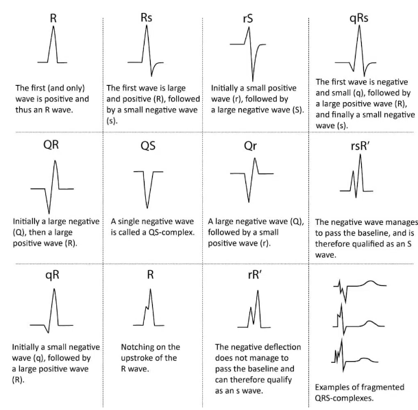 EKG, ECG, 심전도 기본개념(P, QRS, T, 심장 탈분극, SA node, NSR, Lead), QT prolong ...