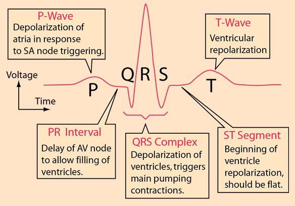 EKG, ECG, 심전도 기본개념(P, QRS, T, 심장 탈분극, SA node, NSR, Lead), QT prolong ...