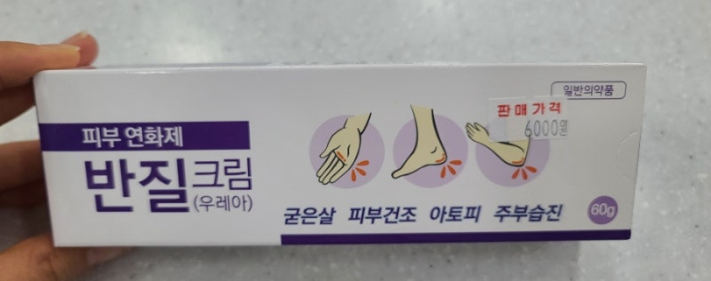 약국에서 사는 굳은살 손발 각질 주부습진에 쓰는 연고 우레아urea 유리아 유레아 크림 피부연화제 각질