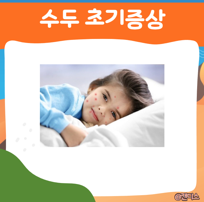 아기 수두 전염 초기증상 치료 예방접종 원인 알아보기 네이버 블로그