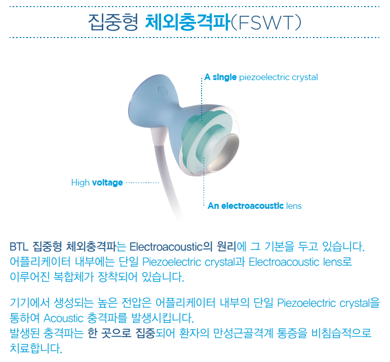 BTL 체외충격파 치료기 (ESWT) "BTL-6000 FSWT" : 네이버 블로그