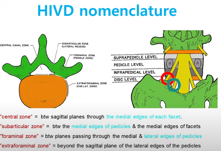 [통증정리] spine MRI reading part 5(에이스병원 유튜브) : 네이버 블로그