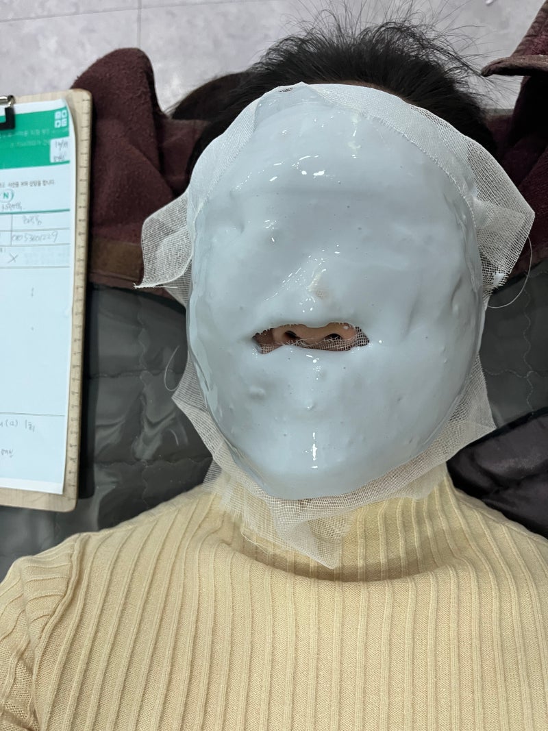 루비레이저 후기 노원역피부과 레이저토닝 발산피부과 네이버 블로그