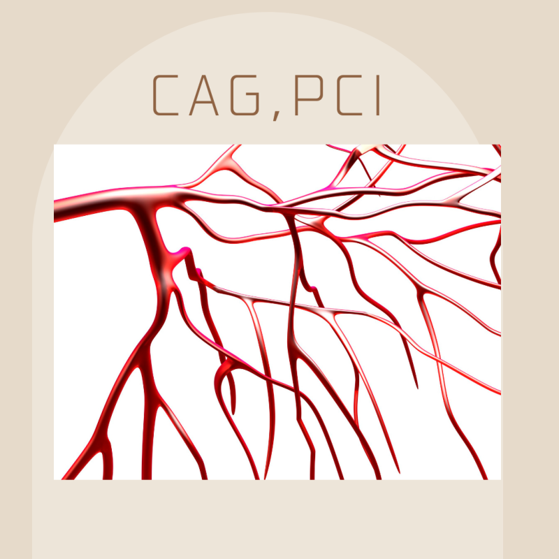 CAG 의학용어 PCI 까지 이해하기 쉽도록 : 네이버 블로그