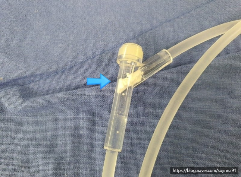 바이파보(byfavo, remimazolam) 사용 후기 : 네이버 블로그