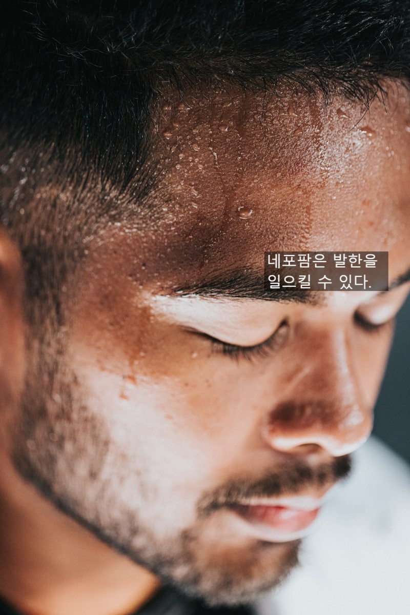 Acupan (아큐판, nefopam) 진통제의 효과와 사용 용량은? : 네이버 블로그