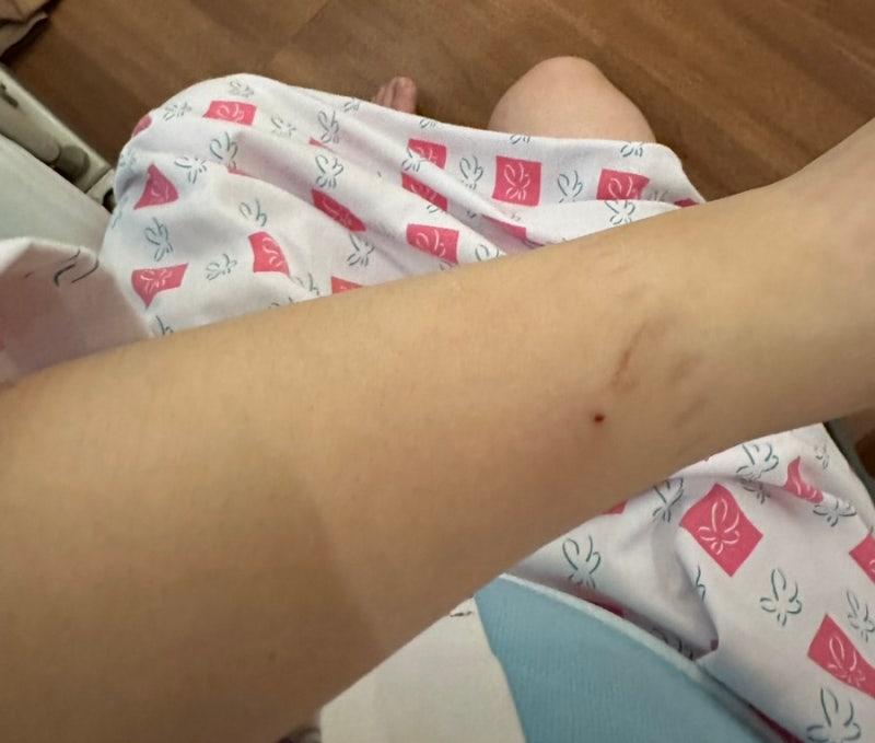 산본제일병원 제왕절개 생생 후기1~2일차 네이버 블로그