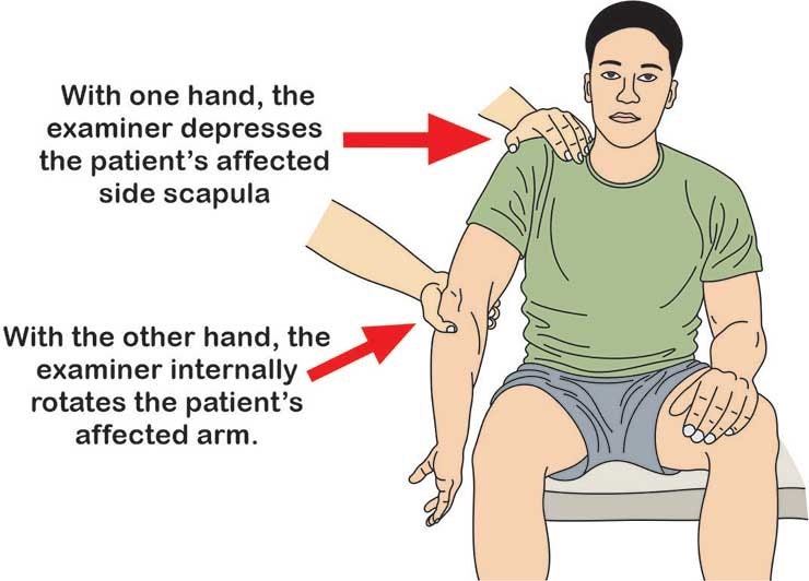 Neer test 검사 방법의 기전과 양성 시 2차 검사법 : 네이버 블로그