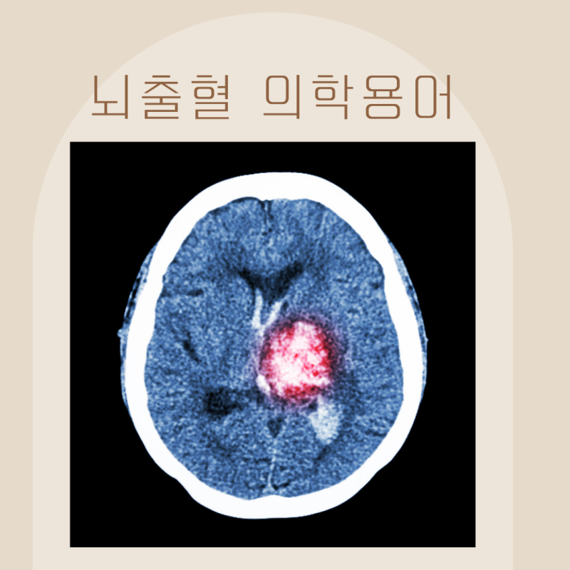 의학용어 ICH IVH EDH SDH SAH 뇌출혈 부위에 따라 : 네이버 블로그