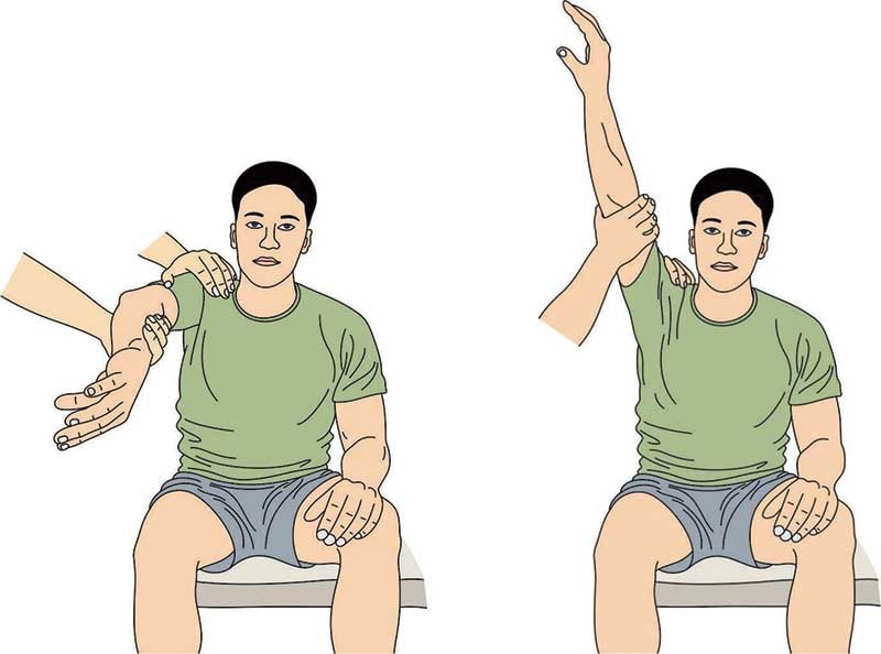 Neer test 검사 방법의 기전과 양성 시 2차 검사법 : 네이버 블로그