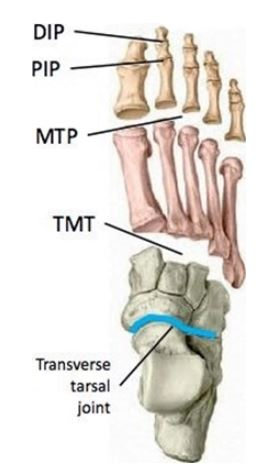 DLBCL, ADPKD, CAVB, MTP joint 의학용어, 의학약어 : 네이버 블로그