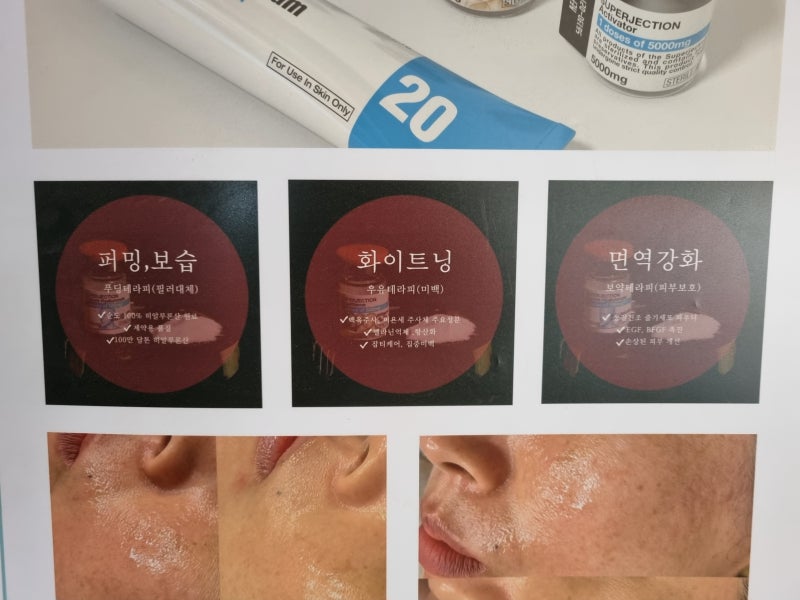 대구 진천동 달서구 피부관리 예니뷰티에스테틱 세멘시트 피부도로공사 네이버 블로그