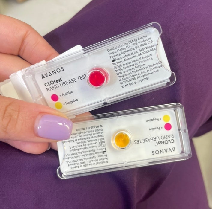 헬리코박터균 CLO / UBT 검사란? : 네이버 블로그