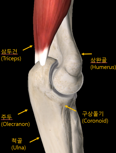 심한 팔꿈치 통증 주두골절 Olecranon Fx 진단과 올바른 수술방법 Ft 척골골절 네이버 블로그