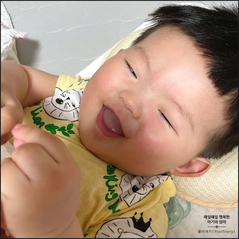 아기 얼굴 상처 피날 때 관리팁 메디폼 에스로반 비판텐 연고 사용 방법 네이버 블로그
