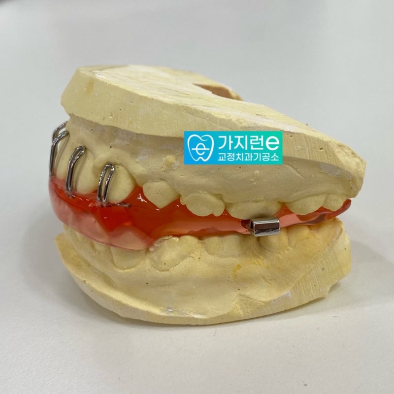 토이셔장치(Teuscher) : 네이버 블로그