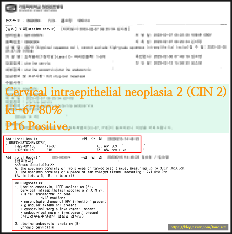 자궁경부의 상피내 신생물 분화도 2n871 제자리암 진단비 지급 가능성 확인하세요 네이버 블로그