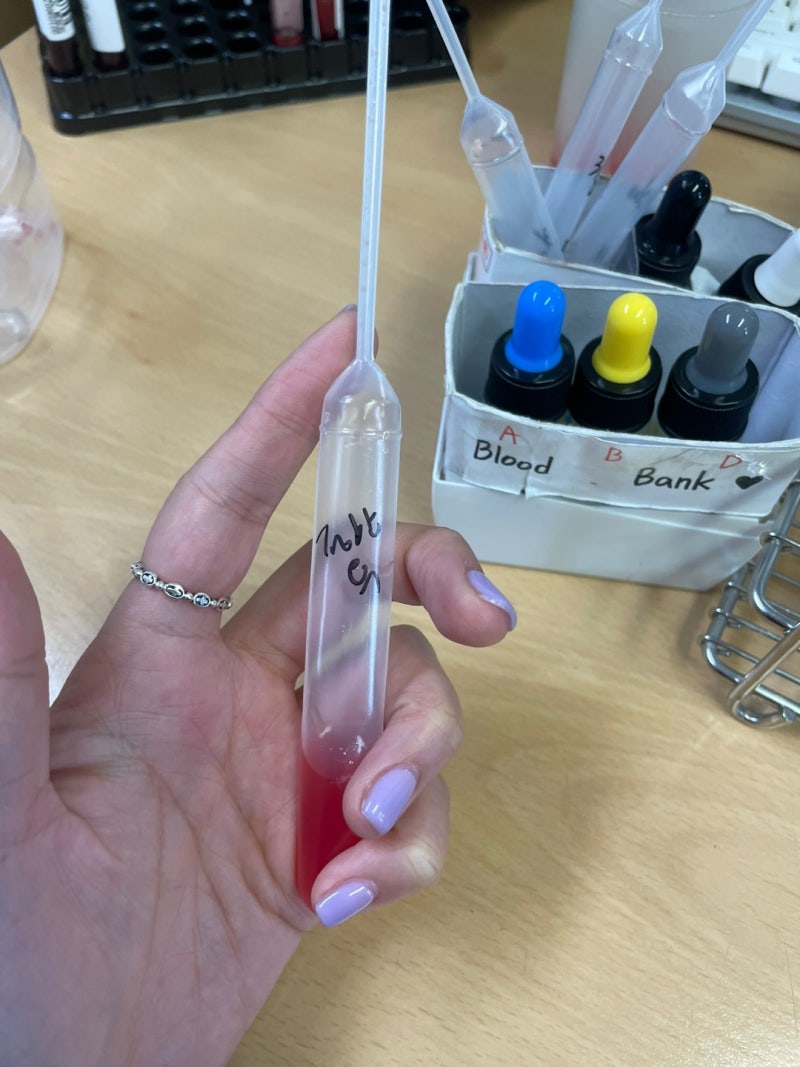 Direct coombs' Test 직접항글로불린 검사 : 네이버 블로그