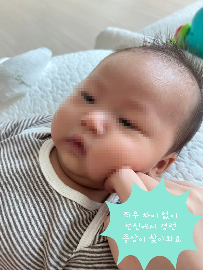 아기 열성경련 열경련 증상 아기 열성경련 증상 원인을 알아봐요 네이버 블로그