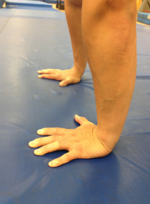 TFCC injury ｜ tfcc치료 방법 선택 어떻게 하나요? [보존적 치료 vs 수술] -2 tfcc 한의원 : 네이버 블로그