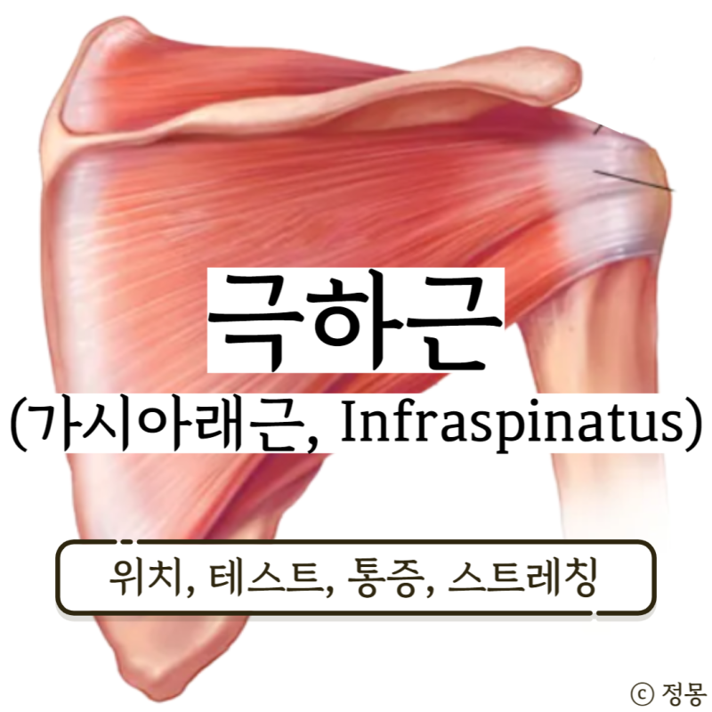 극상근 극하근 극하근 통증 위치 테스트 스트레칭 가시아래근infraspinatus 네이버 블로그