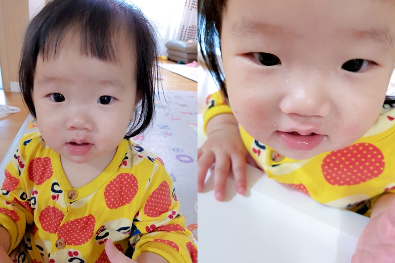 신생아 태열 증상 아기 태열 관리방법 아기피부 오돌토돌 네이버 블로그