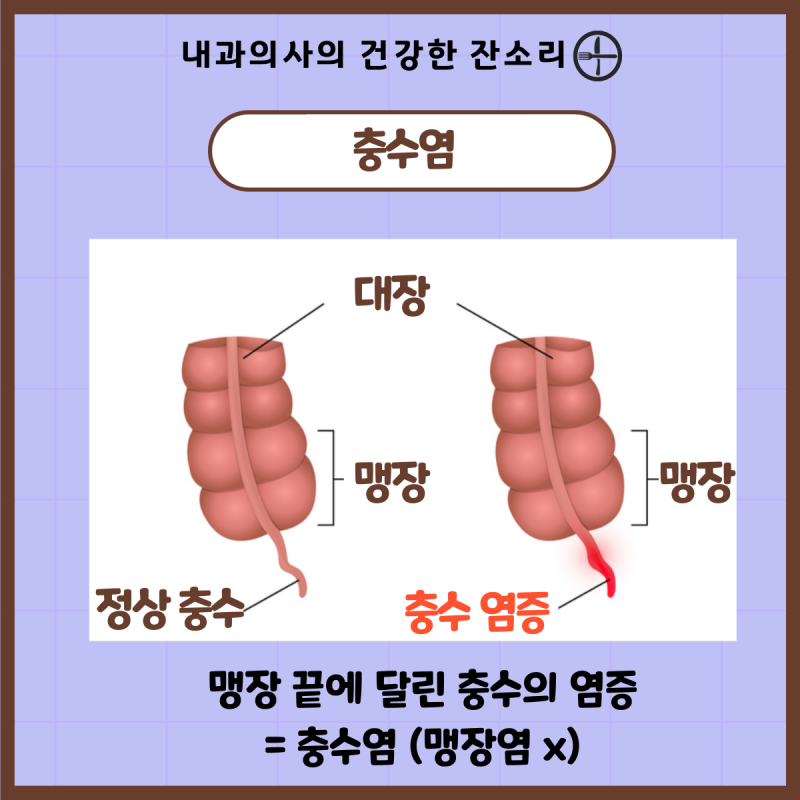 오른쪽 아래 맹장염 배 아픈데 참으면 터져 충수염 초기증상 진행 양상 네이버 블로그