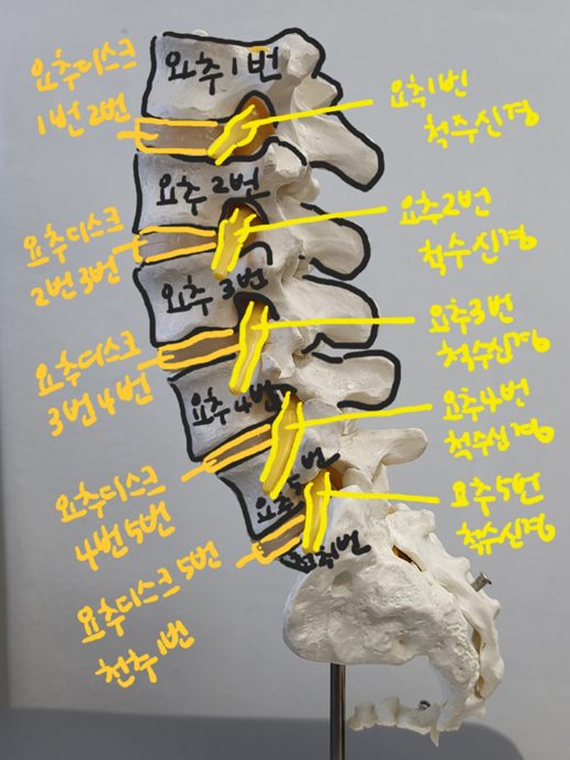 허리통증 다리저림 요추 척추관 협착증의 증상 증세가장 특징적인 증상 신경인성 간헐적 파행 오래 걸을 수 없어요