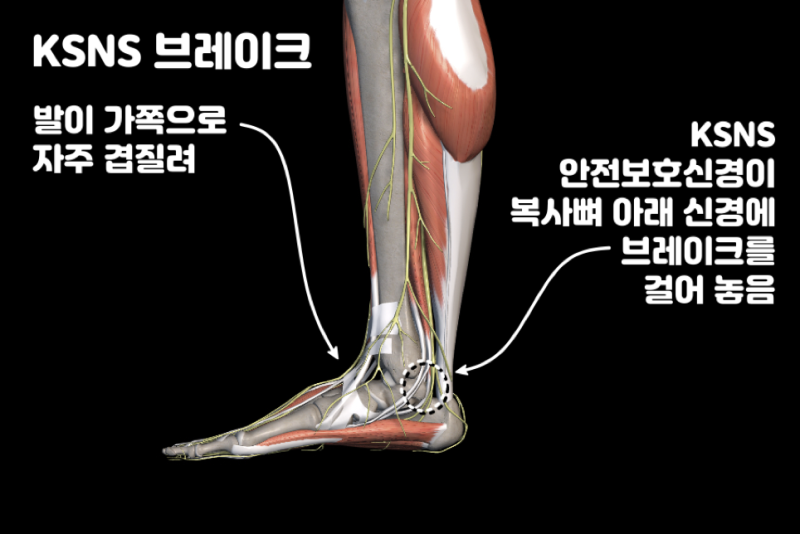 296. 병명 불확실 18년 고통 KSS 스본 스도 5분 만에 힘을 찾다 : 네이버 블로그