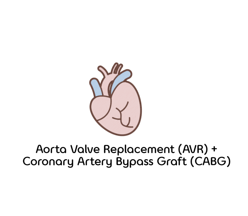Aorta Valve Replacement (AVR) + Coronary Artery Bypass Graft (CABG ...
