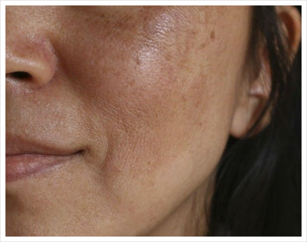 도미나크림 효과 및 사용법 얼굴 접촉성피부염 등 주의사항 체크 약국 가격 네이버 블로그