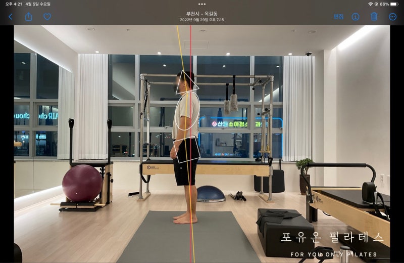 옥길 필라테스 포유온 필라테스 Mens 11 50회차 Before And After 네이버 블로그