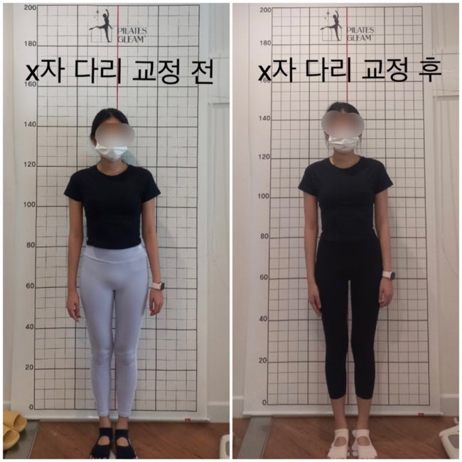 산성역필라테스포레스티아필라테스필라테스글림 개인레슨 전and후 비교사진입니다 네이버 블로그