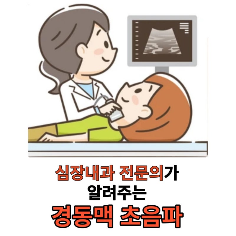 경동맥 초음파 검사 필요성방법비용결과협착증실비 네이버 블로그