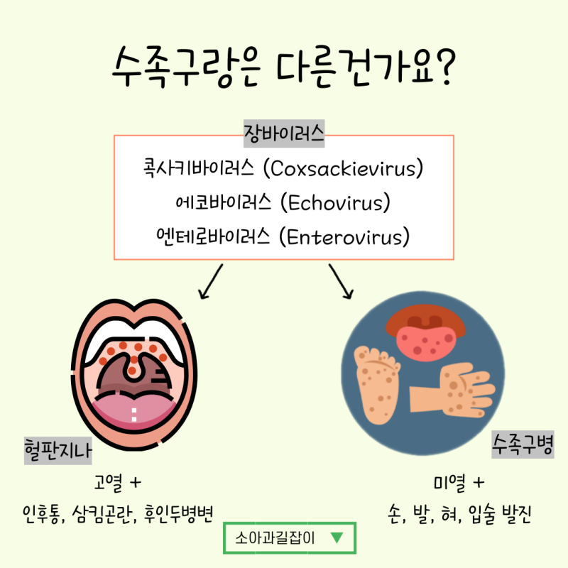 Herpangina (헐판지나, 헤르페스 목구멍염), 수족구와의 차이점? 어린이집 등원, 격리 정리해 드려요. : 네이버 블로그