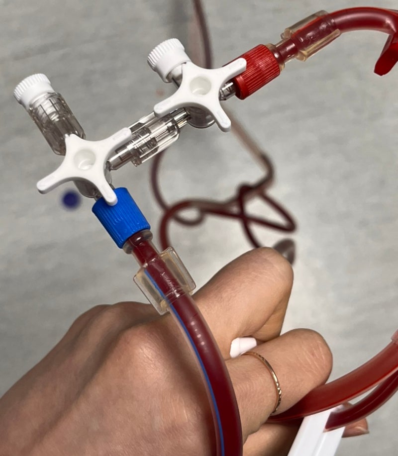 [ CRRT(Continuous Renal Replacement Therapy) chapter 3 l 재순환, 혈액 재순환 ...