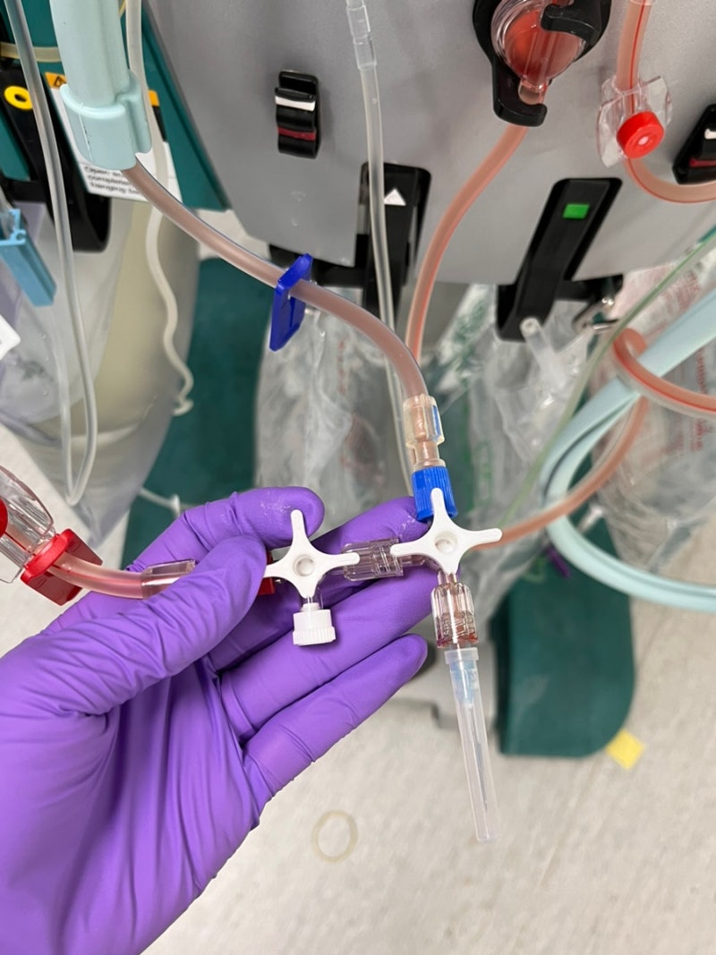 [ CRRT(Continuous Renal Replacement Therapy) chapter 3 l 재순환, 혈액 재순환 ...